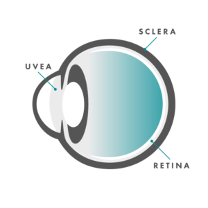 Uveitis / Intraocular Inflammation | Southern Eye Center